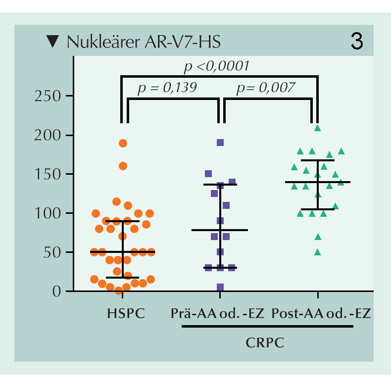 CRPC: AR-V7 als Biomarker für die Therapiewahl bei mCRPC-Patienten ...